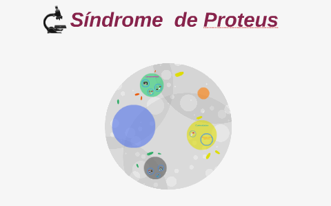 Síndrome de Proteus by on Prezi