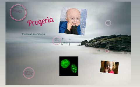 Progeria by Audrey Judd on Prezi