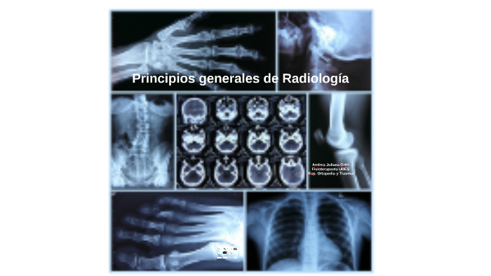 Principios generales de radiologia by Andrea Juliana Ortiz on Prezi