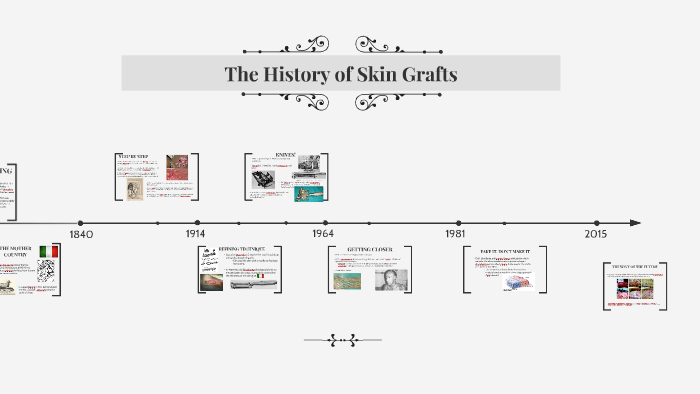 The History of Skin Grafts by Vanessa Di Palma on Prezi
