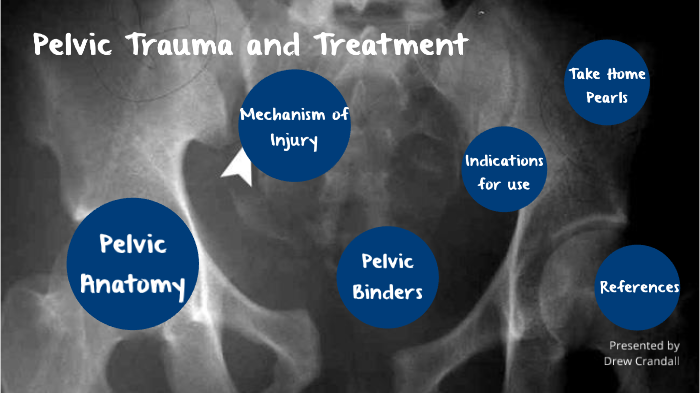 Pelvic Trauma and Treatment by Drew Crandall on Prezi
