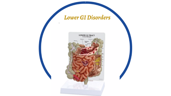 Lower GI Disorders by Jenn McCartney