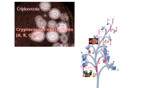 Criptococosis by Valeria Cedillo on Prezi