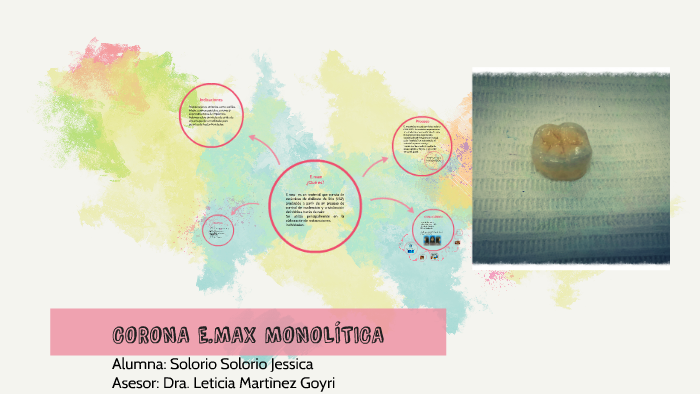 CORONA E.MAX MONOLÍTICA by Jessica Solorio on Prezi