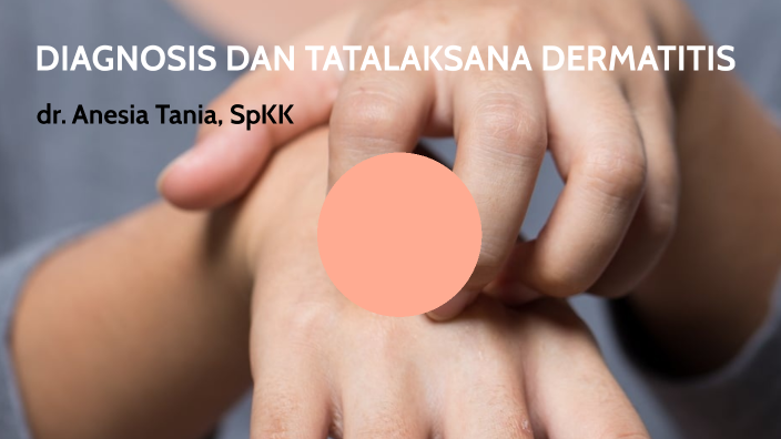 DIAGNOSIS DAN TATALAKSANA DERMATITIS by Anesia Tania on Prezi