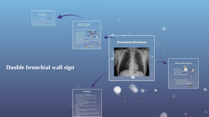 Double bronchial wall sign by Albert Szabó on Prezi