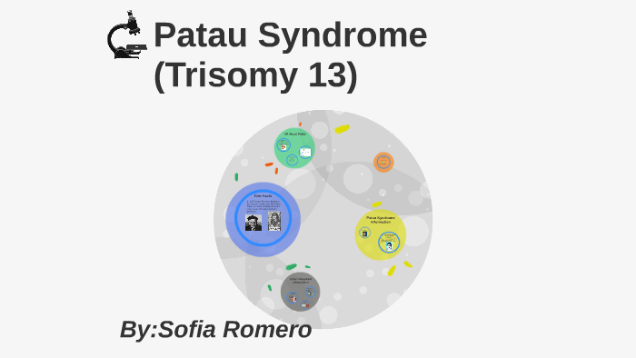Patau Syndrome (Trisomy 13) by Sofia Romero