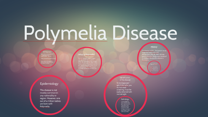 Polymelia Disease by leila duenas on Prezi