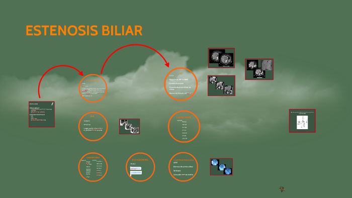 ESTENOSIS BILIAR by Micaela Abrego on Prezi