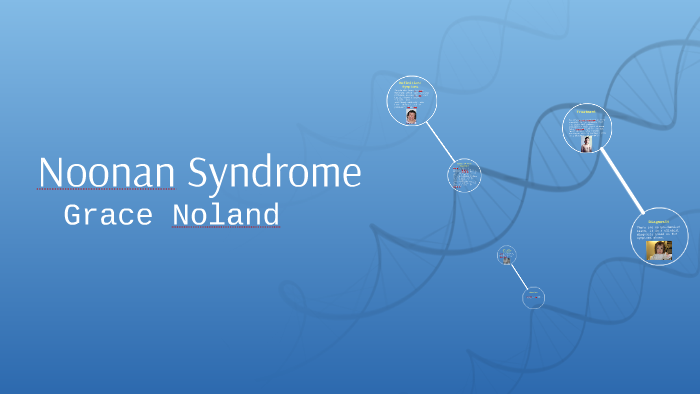 Noonan Syndrome by Grace Noland on Prezi