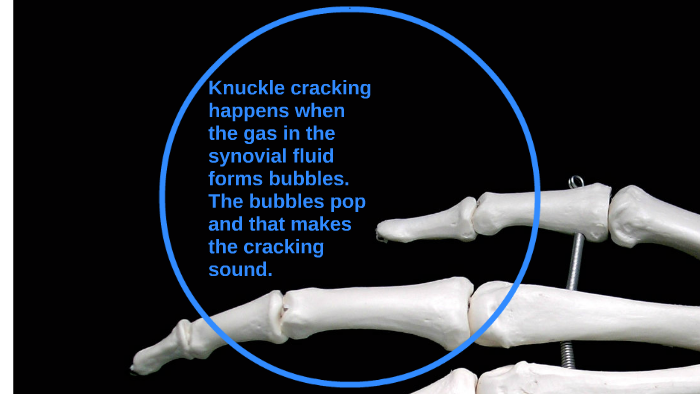What Is Knuckle Cracking by evy becker on Prezi