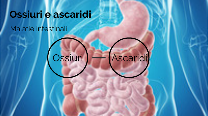 Ossiuri e ascaridi by Leonard Laconi on Prezi