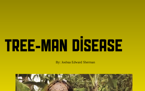 Tree-man Disease (By: Joshua Sherman) by Eddy Edward on Prezi