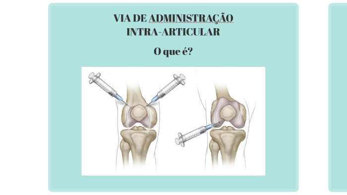 VIA DE ADMINISTRAÇÃO INTRA-ARTICULAR by Ana Cavalari on Prezi