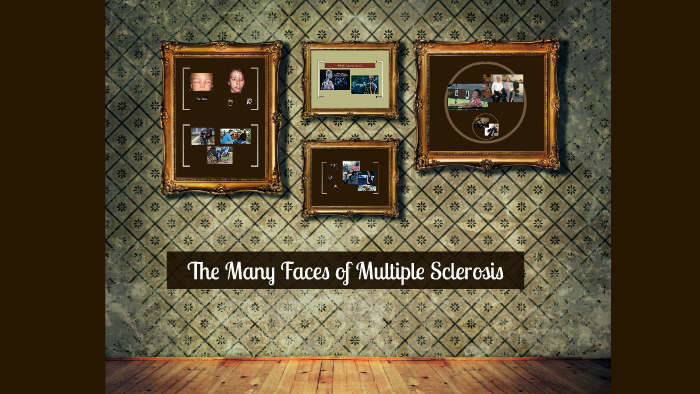The Many Faces of Multiple Sclerosis by Ivy ta on Prezi