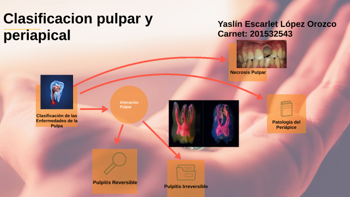 Diágnostico Pulpar y periapical Mapa Mental by Yaslin Escarlet López Orozco on Prezi
