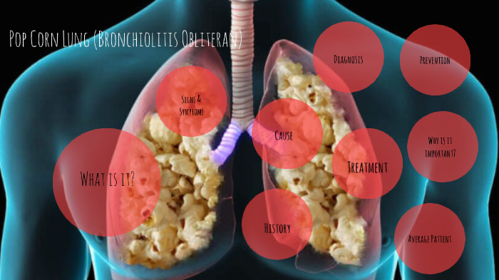 Pop Corn Lung by Sara Ayad on Prezi