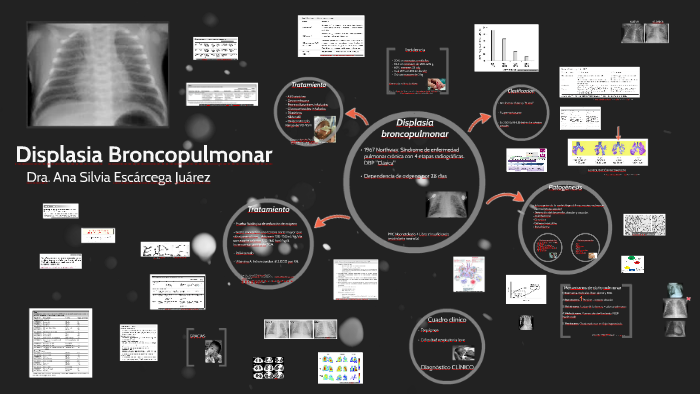 Displasia Broncopulmonar by Ana Escarcega on Prezi