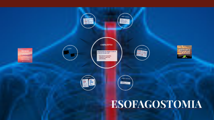 ESOFAGOSTOMIA by LIZETA CRUZ on Prezi