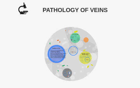 PATHOLOGY OF VEINS by Kaitlyn Wilson on Prezi