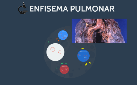 ENFISEMA PULMONAR by Alexis Bahena on Prezi