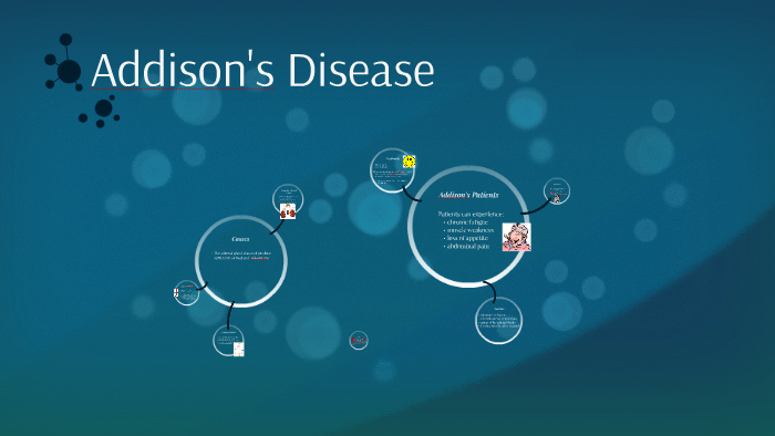 Addison's Disease by Dana Laughlin on Prezi