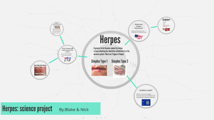 Herpes: science project by nick henriquez on Prezi