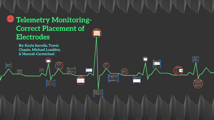 Telemetry Monitoring-Correct Placement of Electrodes by on Prezi