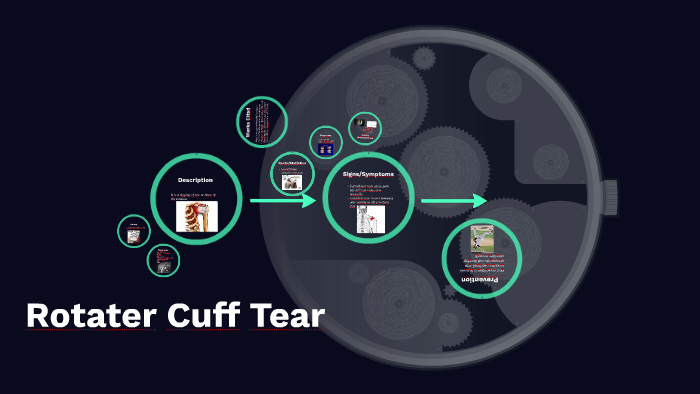Rotater Cuff Tear by Trevor Gutt on Prezi