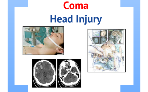 Coma - Head Injury by V Seng on Prezi