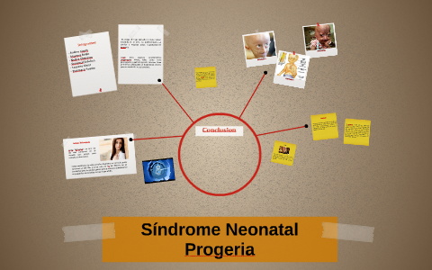 Síndrome Neonatal Progeria by Belen Moyano on Prezi