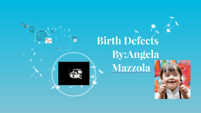 Birth defects by Angela Mazzola on Prezi