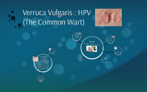 Verruca Vulgaris by damoun rezai on Prezi