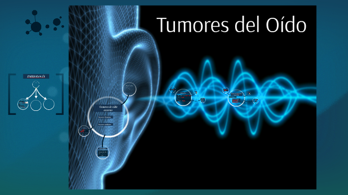 Tumores del Oído by lilian camargo on Prezi