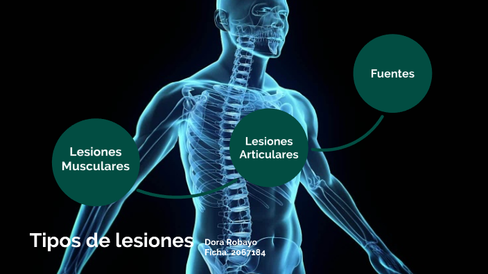 Tipos de lesiones by DORA MARIA ROBAYO GUZMAN on Prezi
