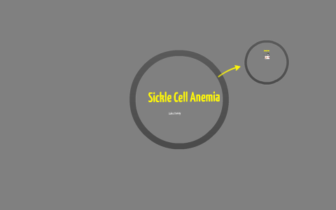 Sickle Cell Anemia by Luke Hovey on Prezi