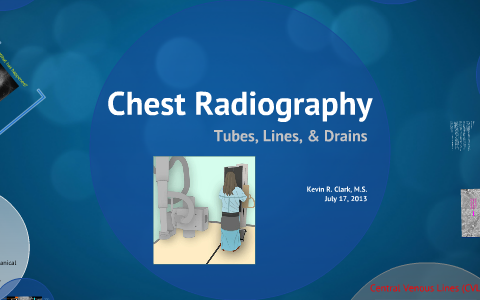 Chest Radiography: Tubes, Lines, & Drains by Kevin Clark on Prezi