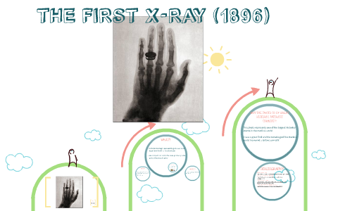 THE FIRST X-RAY (1896) by katie shaw on Prezi