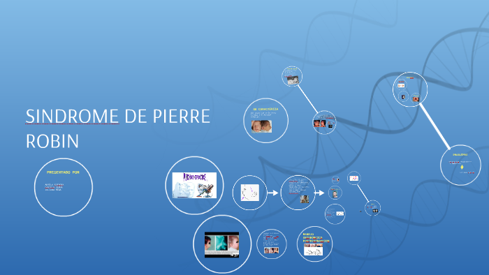SINDROME DE PIERRE ROBIN by juliana mesa on Prezi