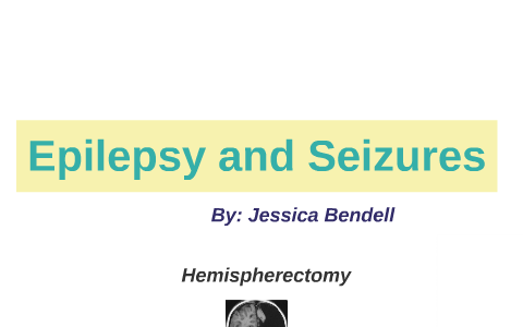 Seizures and Epilepsy by Jessica Bendell on Prezi