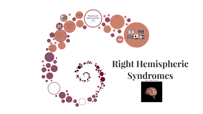 Right Hemispheric Syndromes by Sophia Hastings on Prezi