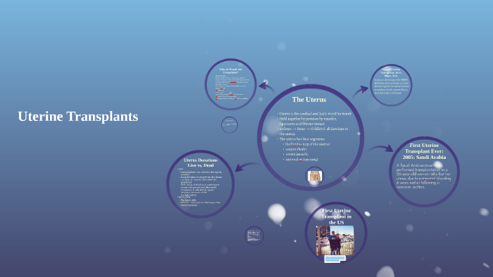 Uterine Transplants by Alexis Capers on Prezi
