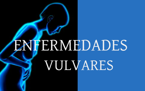 enfermedades vulvares by Andrés Cárdenas on Prezi
