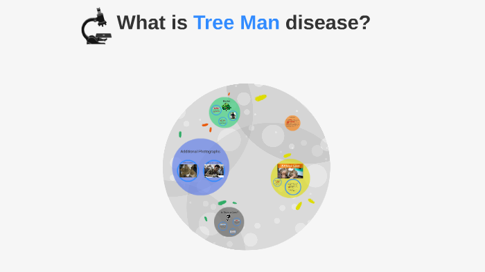 What is Tree Man disease? by Tessa Berube on Prezi