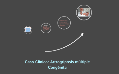 Caso Clínico: Artrogriposis múltiple Congénita by Wanda Fernandez on Prezi