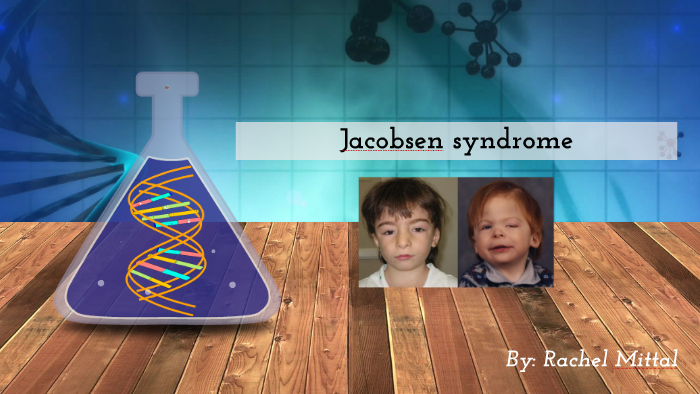 Jacobsen's Syndrome by Rachel Mittal on Prezi