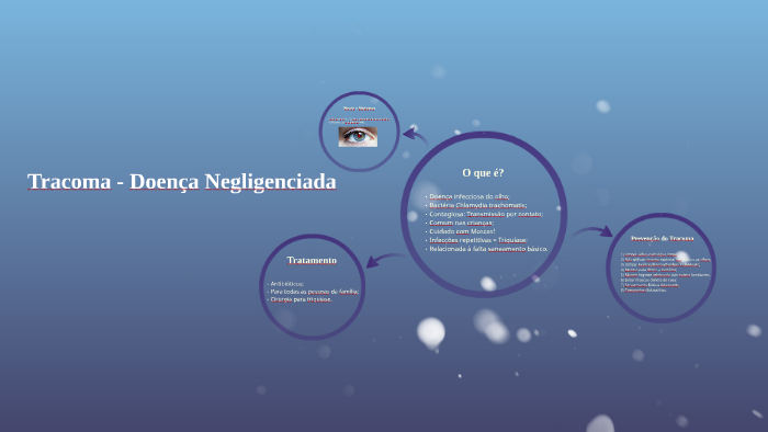 Tracoma - Doença Negligenciada by Felipe Silva on Prezi