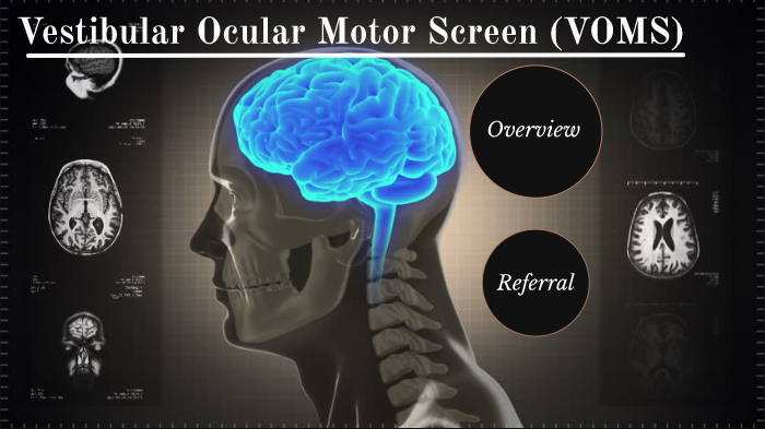 VOMS by Jason Castleman on Prezi