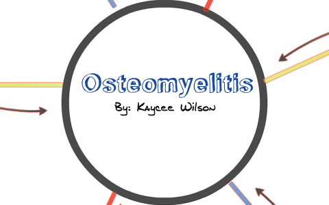 Osteomyelitis by Kaycee Wilson on Prezi