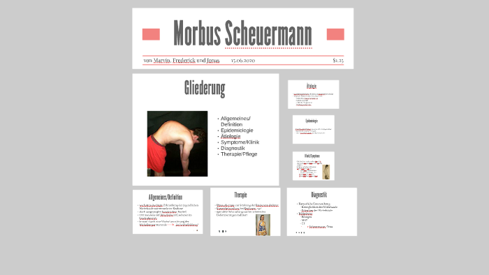 Morbus Scheuermann by Jonas Kuster on Prezi